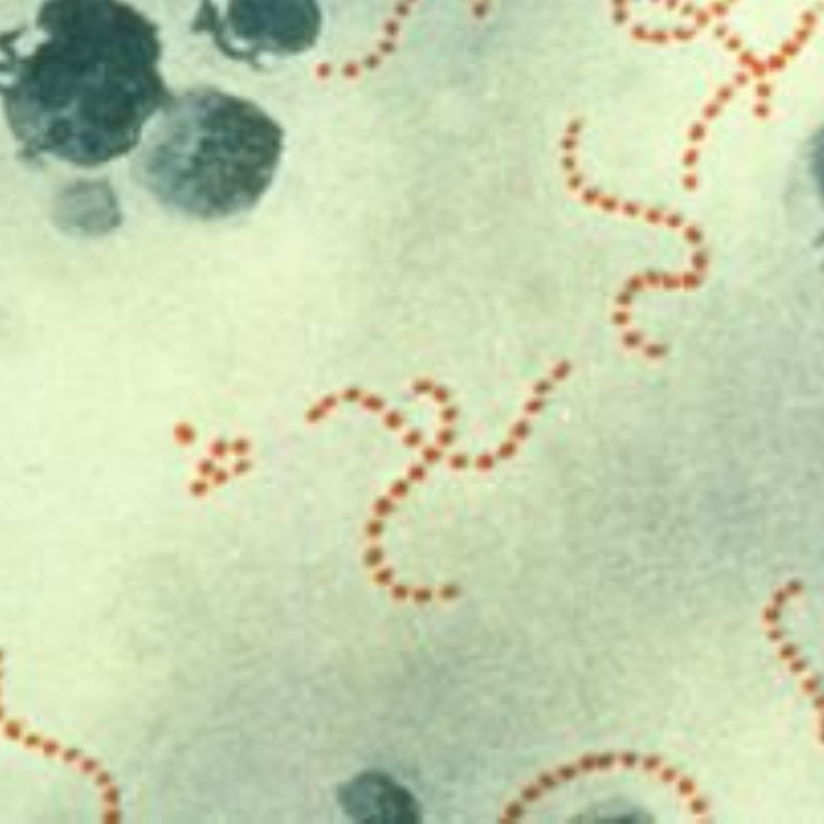 Norwood Primary School - Scarlet Fever and Invasive Group A Strep.