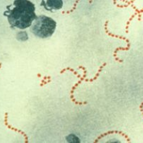 Norwood Primary School - Scarlet Fever and Invasive Group A Strep.